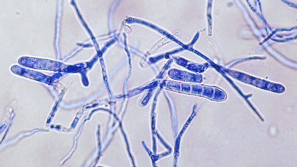 Superficial Mycoses